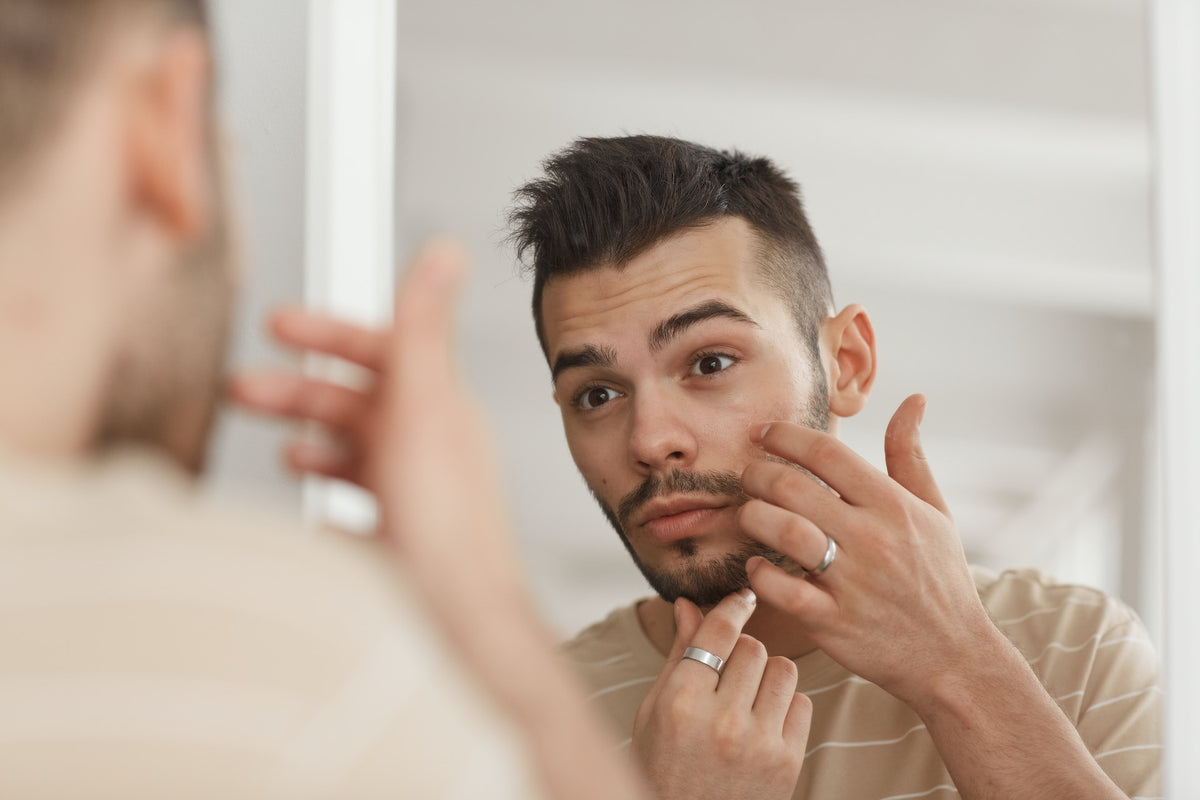 Mastering Men's Winter Skincare: The Guide to Combating Dryness and Ir ...